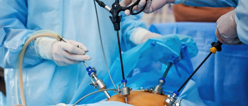 General Surgery - Best Multispeciality Hospital in Bengaluru | Mahanth ...